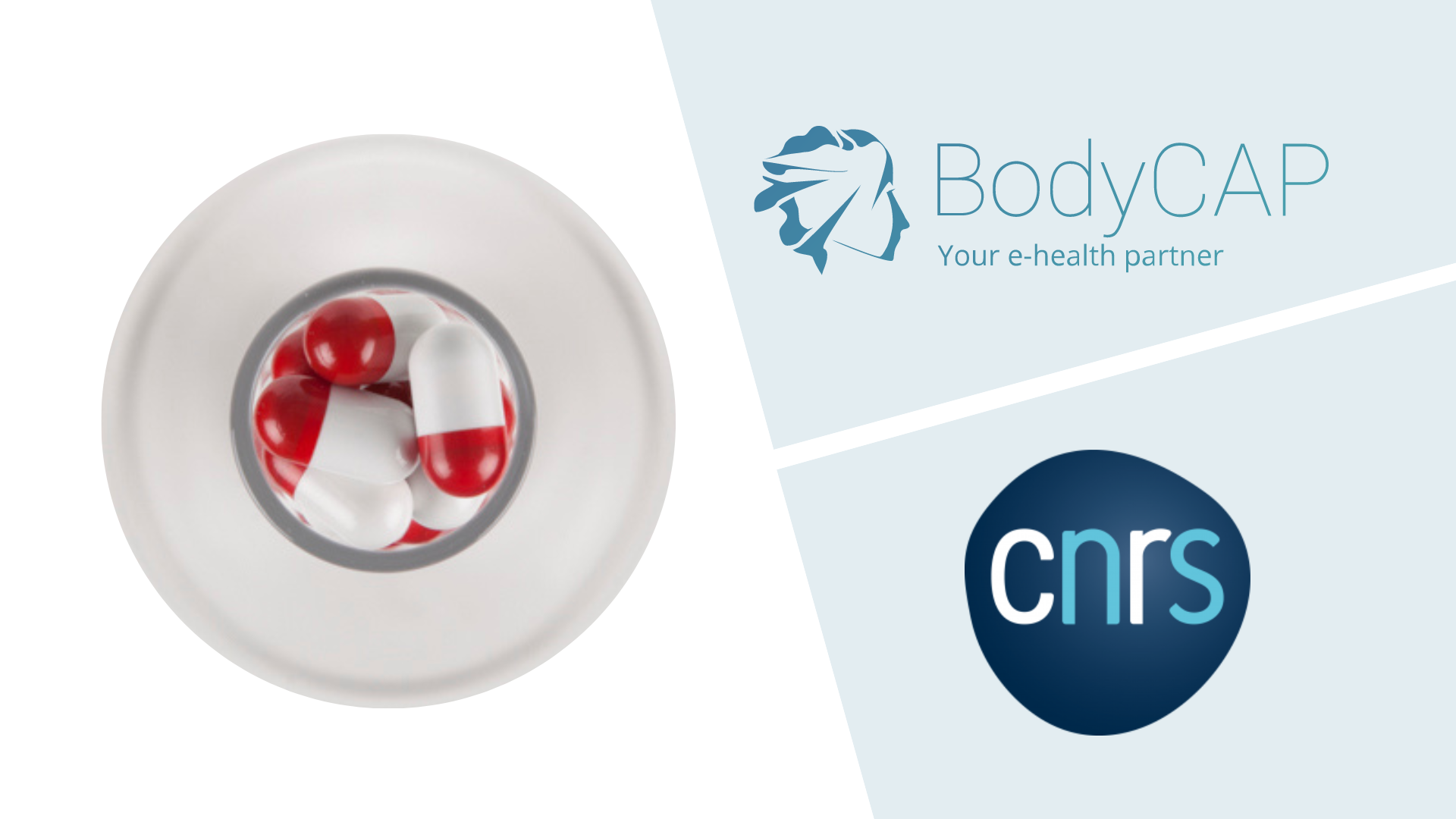 Develop videocapsule for gastrointestinal diseases | Bodycap Medical